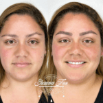 Microblading Gone Wrong: How To Avoid A Botched Eyebrows