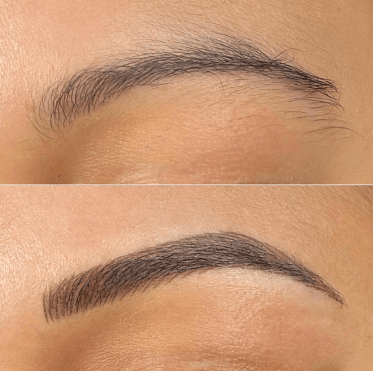 Nanoblading | The Art Of Perfectly Natural Brows